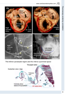 Cardiac Anatomy for Electrophysiologist - Atlas