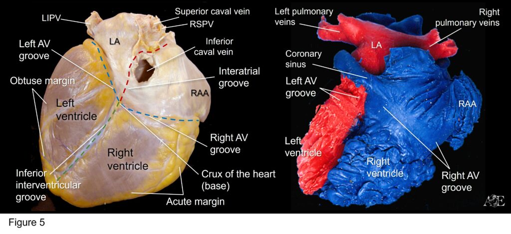 Atlas - Cardiac Anatomy for Electrophysiologist