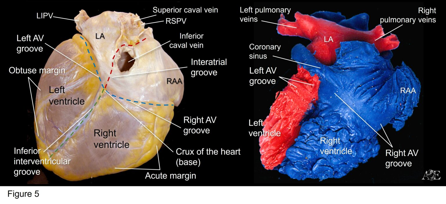 Atlas - Cardiac Anatomy for Electrophysiologist