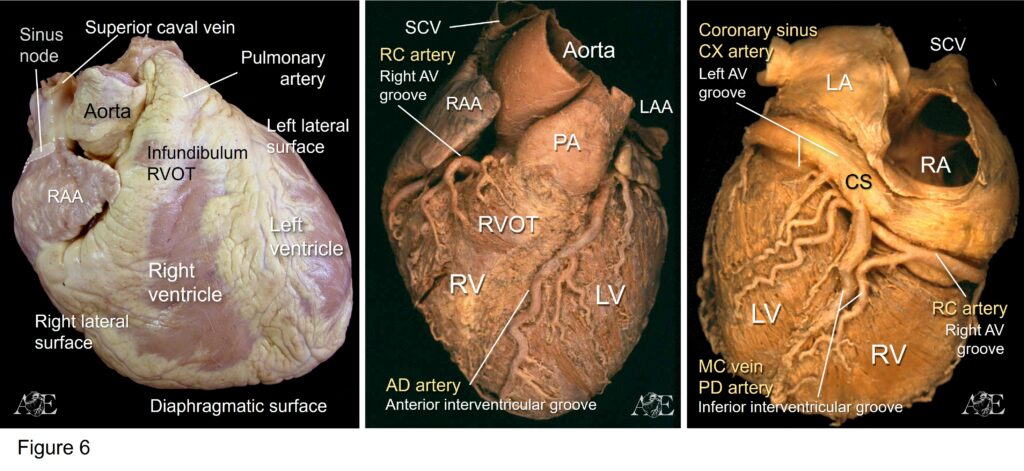 Atlas - Cardiac Anatomy for Electrophysiologist
