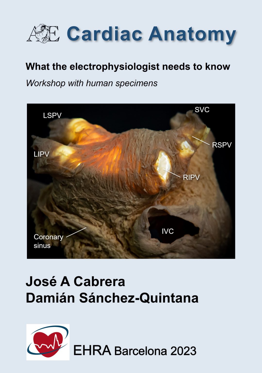 Cardiac Anatomy for Electrophysiologist - Atlas